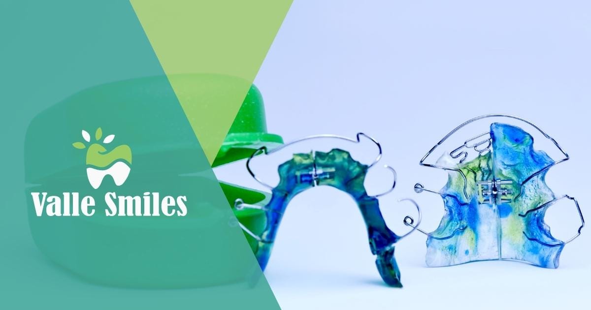 Bite Alignment | Valle Smiles | Orthodontics, Retainers